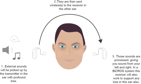 Further Phonak models | Richmond Hearing