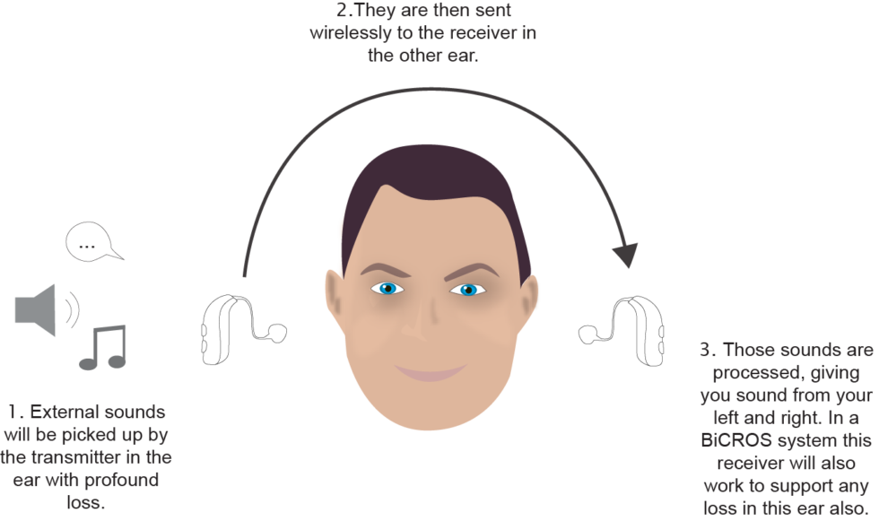 Further Phonak models | Richmond Hearing